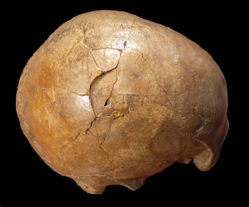 News - Upper Paleolithic Skull Injuries Analyzed - Archaeology Magazine