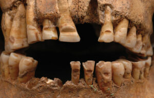 Features - Ancient DNA Revolution - Archaeology Magazine - September ...