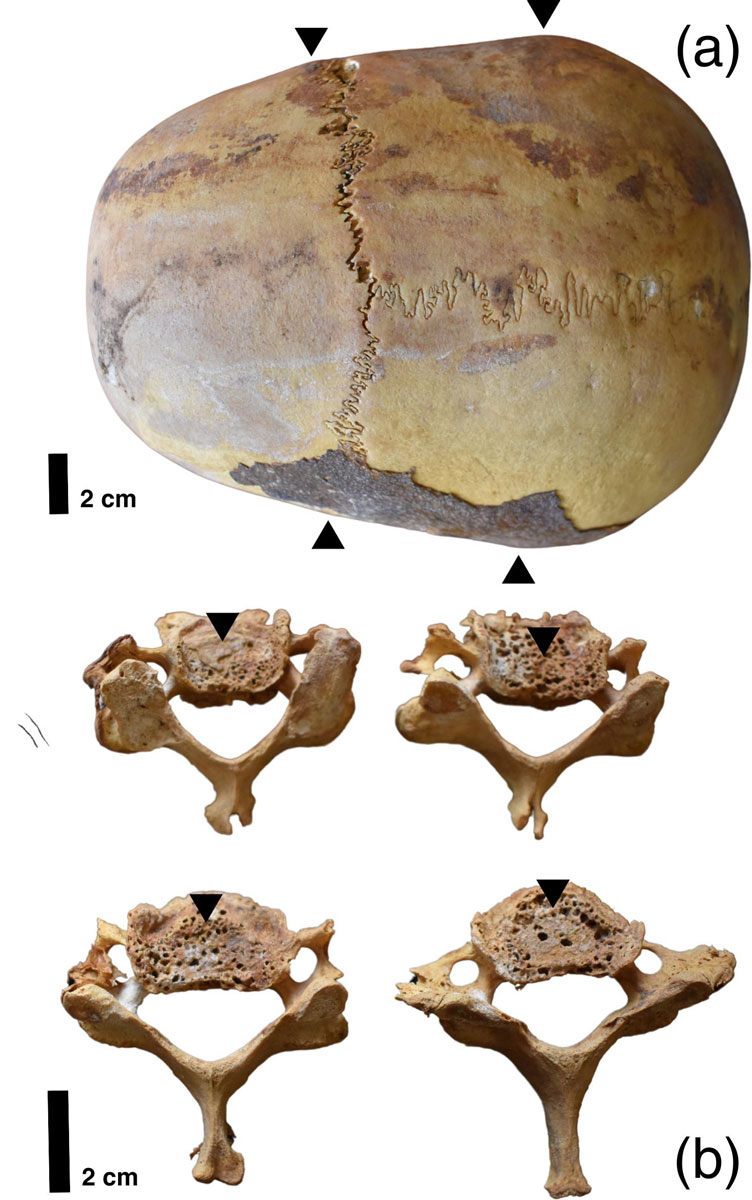 News - Oldest Evidence of Tumpline Head Strap Use Identified in Sudan ...